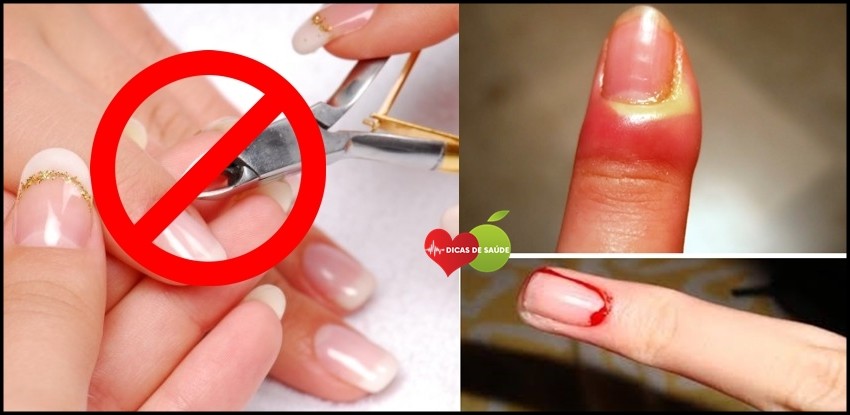 Como Remover as Cutículas SEM Alicate em 5 Minutos | Dicas de Saúde