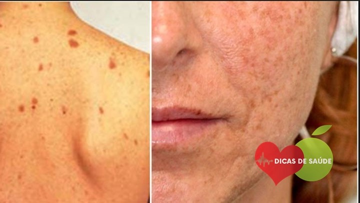 Os 10 Principais Sinais de Câncer que Muitos Ignoram | Dicas de Saúde