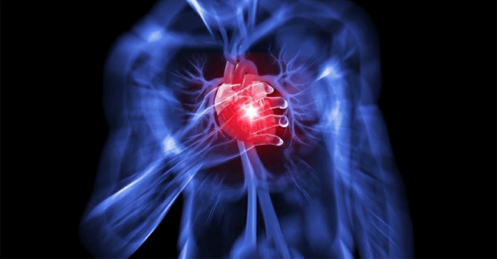 Ataque Cardíaco - O que é, Sintomas, Causas e Tratamentos | Dicas de Saúde