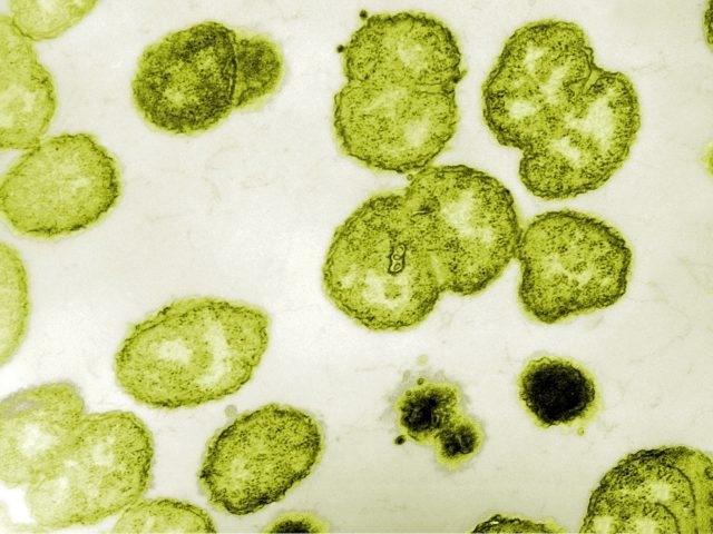 Gonorreia - O que é, Causas, Sintomas e Tratamento | Dicas de Saúde