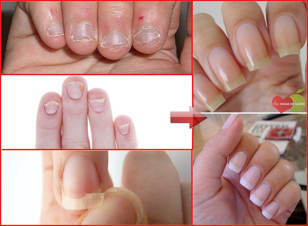 As 3 Dicas Simples Para Ter Unhas Grandes, Fortes e Saudáveis