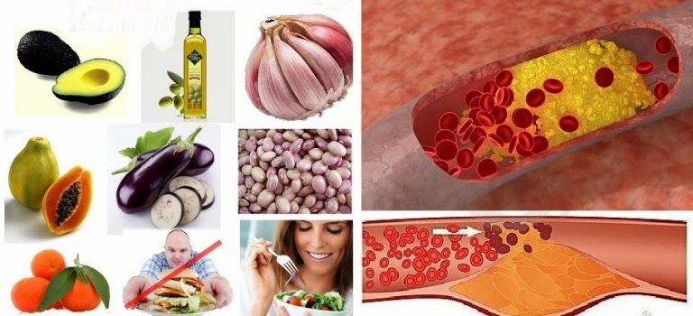 As 5 Dicas Para Reduzir o Níveis de Triglicerídeos Elevado | Dicas de Saúde