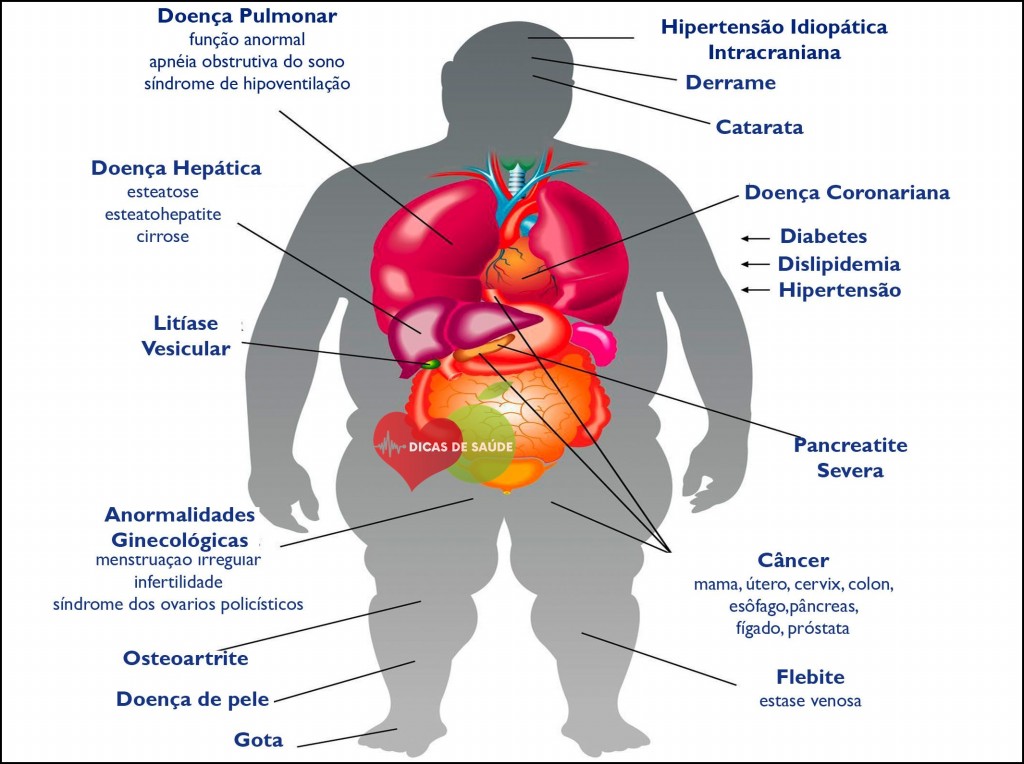 As 5 Doenças Causadas Pela Obesidade | Dicas de Saúde
