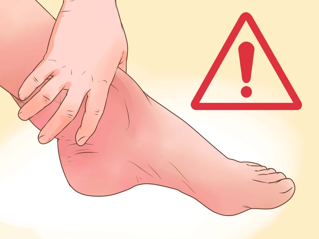 As 3 Dicas de Como Acabar com Inchaço no Corpo 【ATUALIZADO】