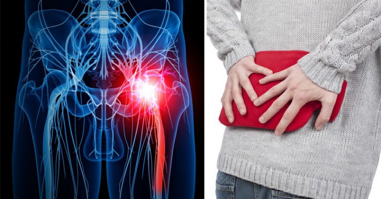 Ciática - O que é, Causas, Sintomas e Tratamentos | Dicas de Saúde