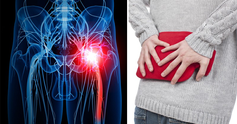 Ciática - O que é, Sintomas e Tratamentos 【ATUALIZADO】