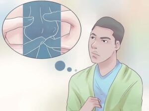 Epididimite – O que é, Causas e Sintomas | Dicas de Saúde