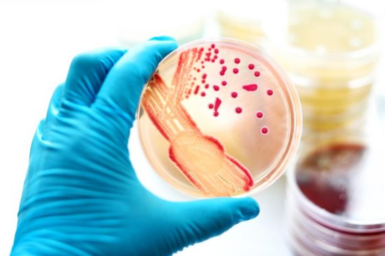 Gonorreia - Causas, Sintomas e Tratamento | Dicas de Saúde