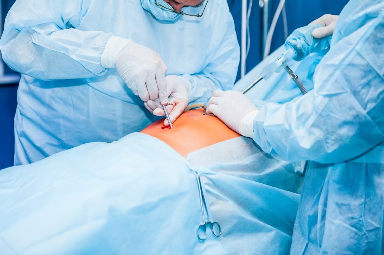 Peritonite - O que é, Sintomas e Tratamentos | Dicas de Saúde