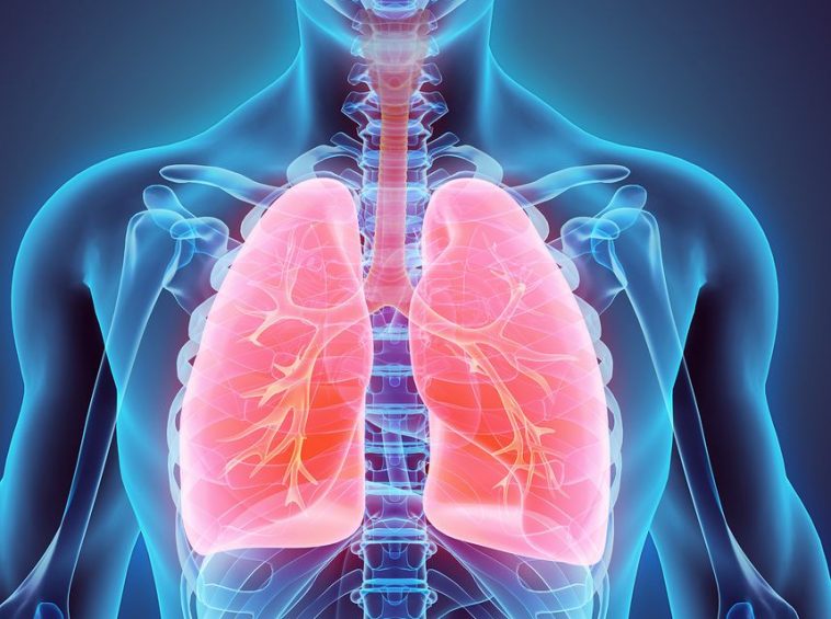 Pleurisia - O que é, Causas, Sintomas e Tratamentos | Dicas de Saúde
