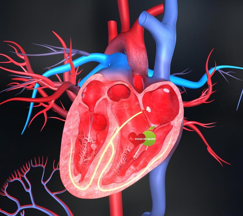 Tumores Cardíacos – O que é, Sintomas e Tratamentos | Dicas de Saúde