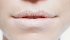 As 12 Principais Causas da Boca Seca 【ATUALIZADO】