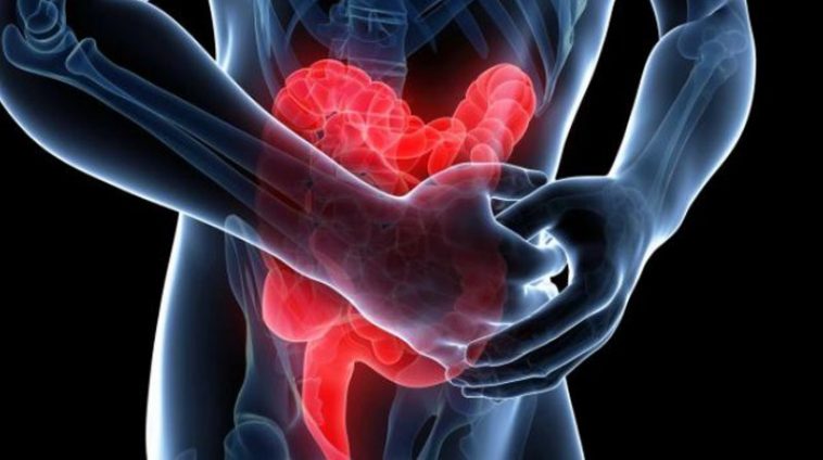 Colite - Causas, Sintomas e Tratamentos 【ATUALIZADO】