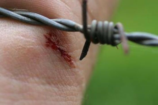 Tétano – O que é, Sintomas e Tratamentos | Dicas de Saúde