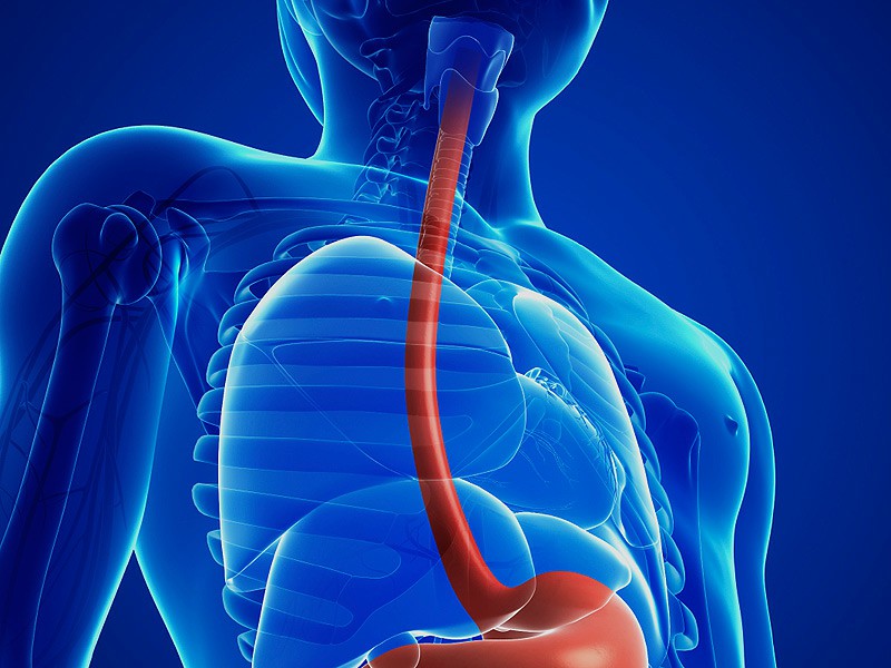 Esofagite Eosinofílica - O que é, Sintomas e Tratamentos 【Atualizado】