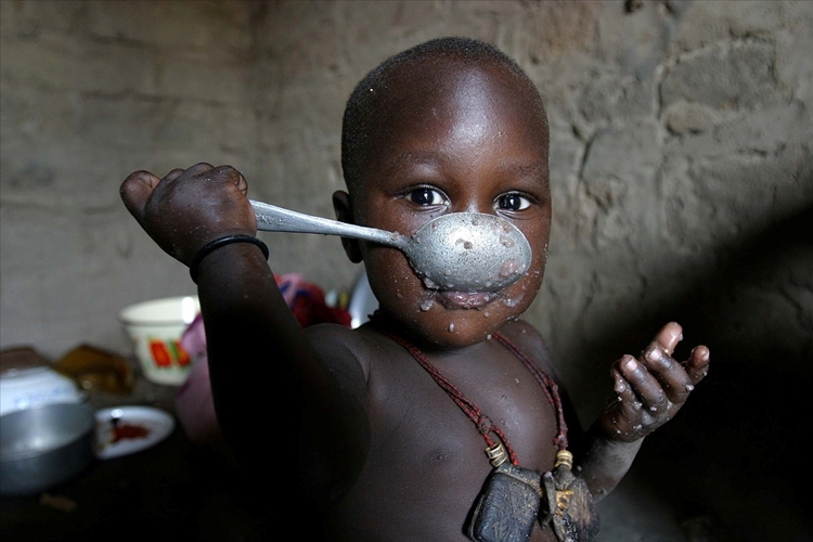 Subnutrição - O que é, Causas, Sintomas e Tratamentos | Dicas de Saúde
