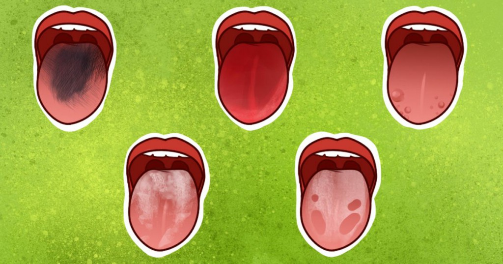 As 7 Coisas que a Sua Língua Pode Dizer Sobre sua Saúde | Dicas de Saúde