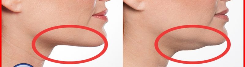 Como ELIMINAR a Papada em Apenas 8 Dias! 【ATUALIZADO】