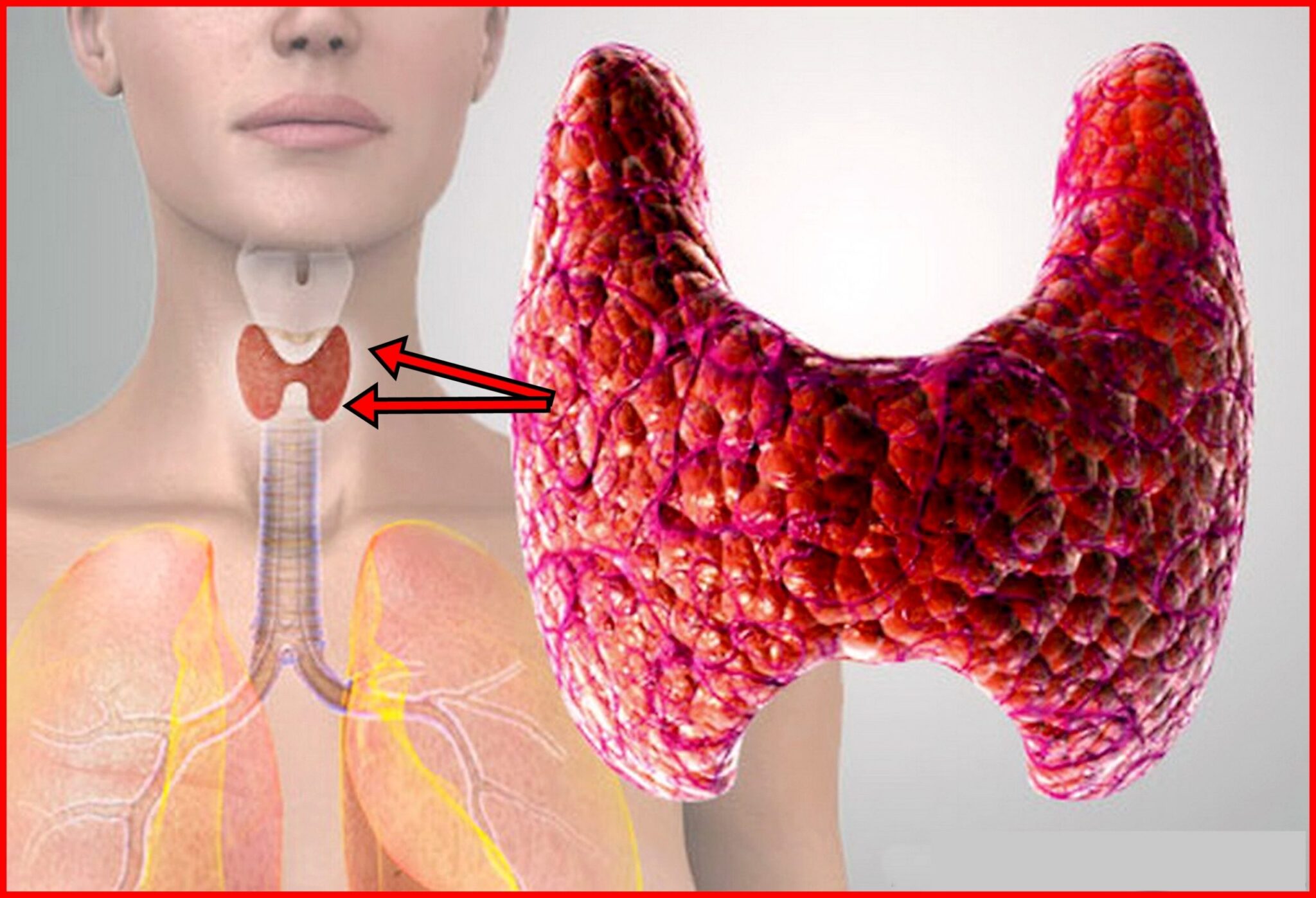 6 principais causas do hipotireoidismo ignoradas! | Dicas de Saúde