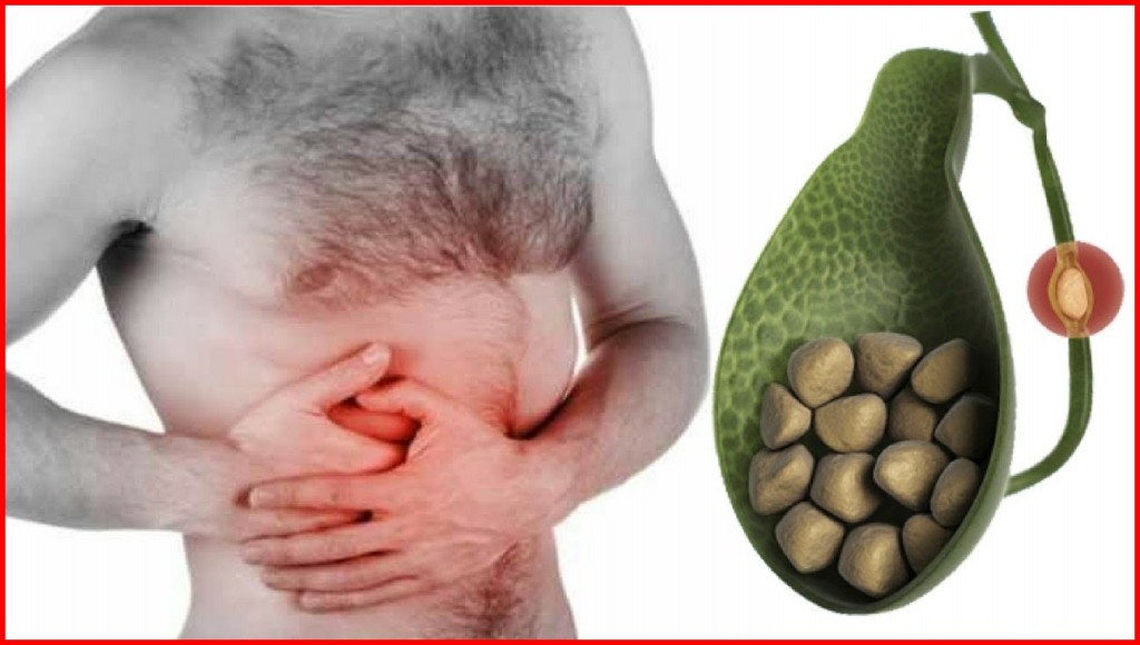 15 Sintomas de Pedra na Vesícula que Poucos Conhecem | Dicas de Saúde 15 Sintomas de Pedra na Vesícula que Poucos Conhecem | Dicas de Saúde