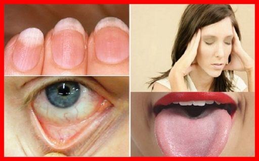 Anisocitose - O que é, causas, sintomas e tratamentos! | Dicas de Saúde