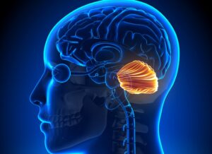 Ataxia cerebelar - sintomas, causas e tratamento natural | Dicas de Saúde